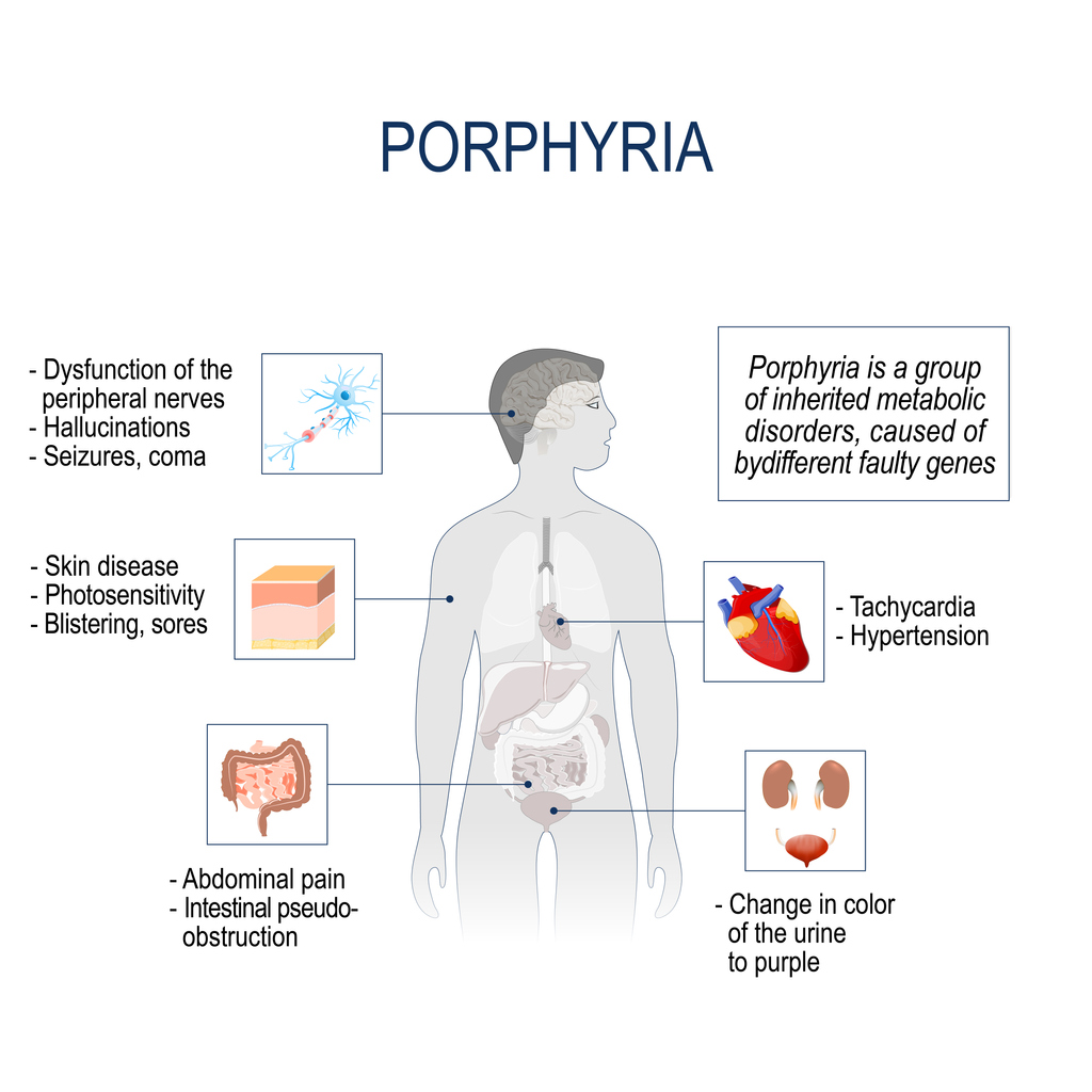 Porphyria | PainScale