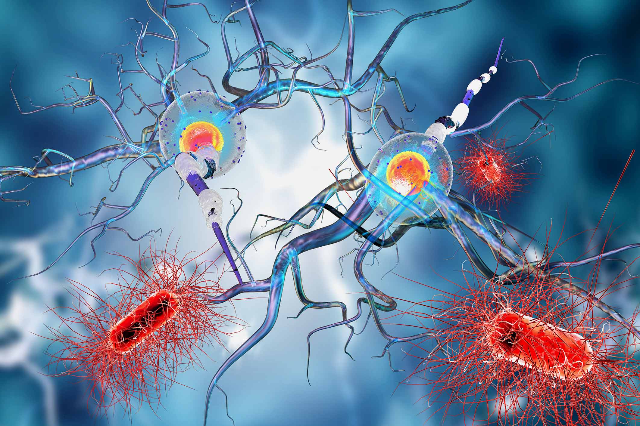 Multiple Sclerosis Risk Factors | PainScale